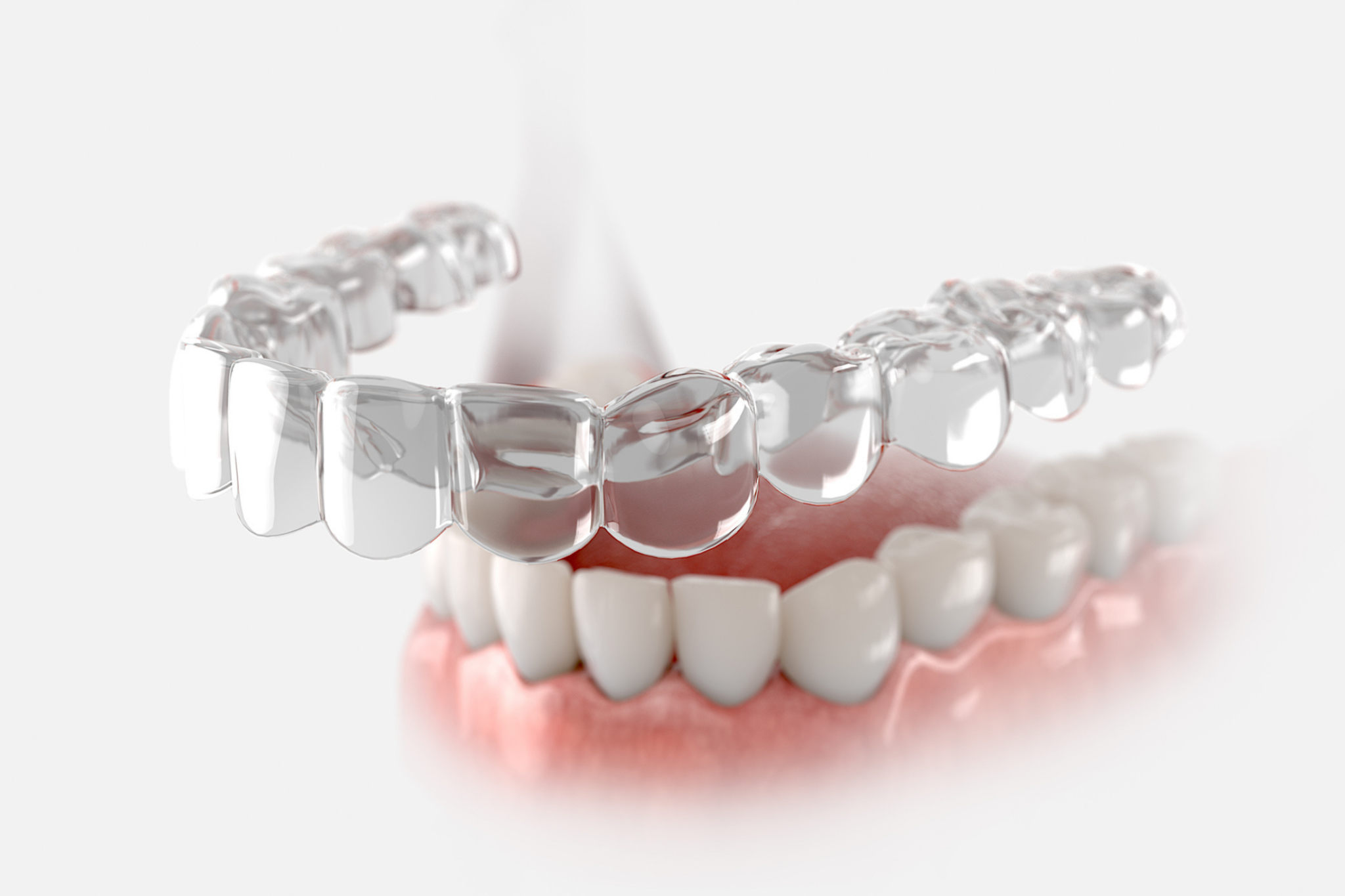 Invisalign Dentist Perth | Invisalign Perth | Invsalign Clinic Perth